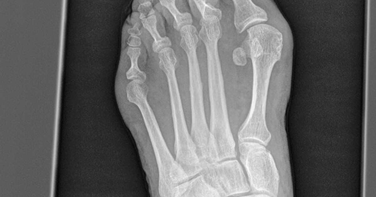 Common Foot Problems in Primary Care | Clinician.com