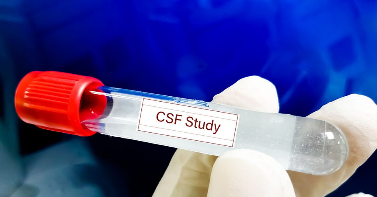 Absence of Pleocytosis in Cerebrospinal Fluid Does… | Clinician.com