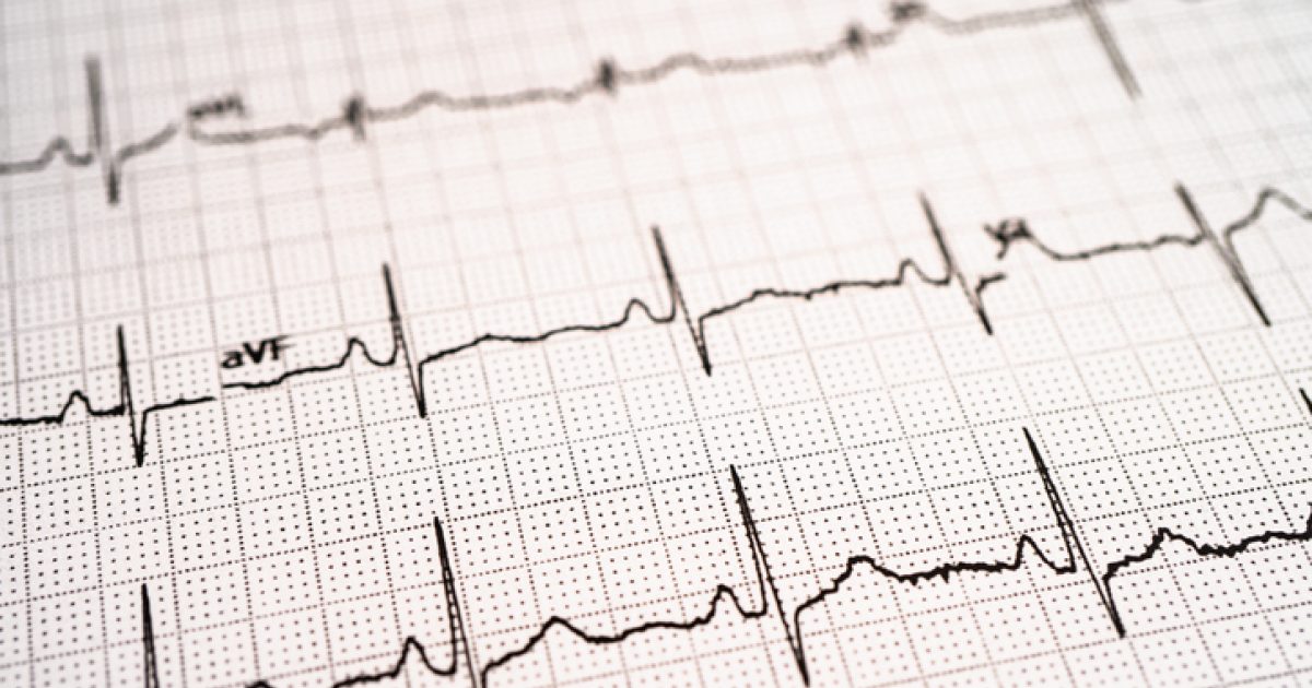 An ECG in Disguise? | Clinician.com