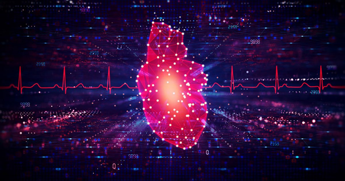 Artificial Intelligence ECG Analysis to Rule Out… | Clinician.com