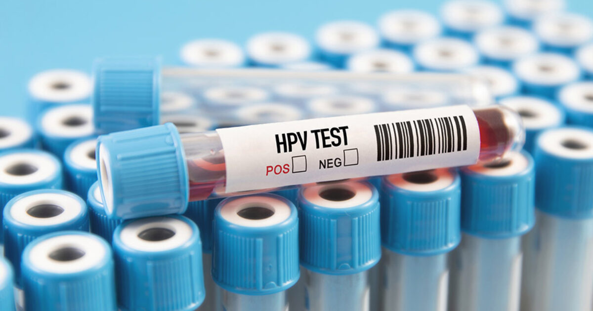 New Guidelines for HPV Testing of Self-Collected… | Clinician.com