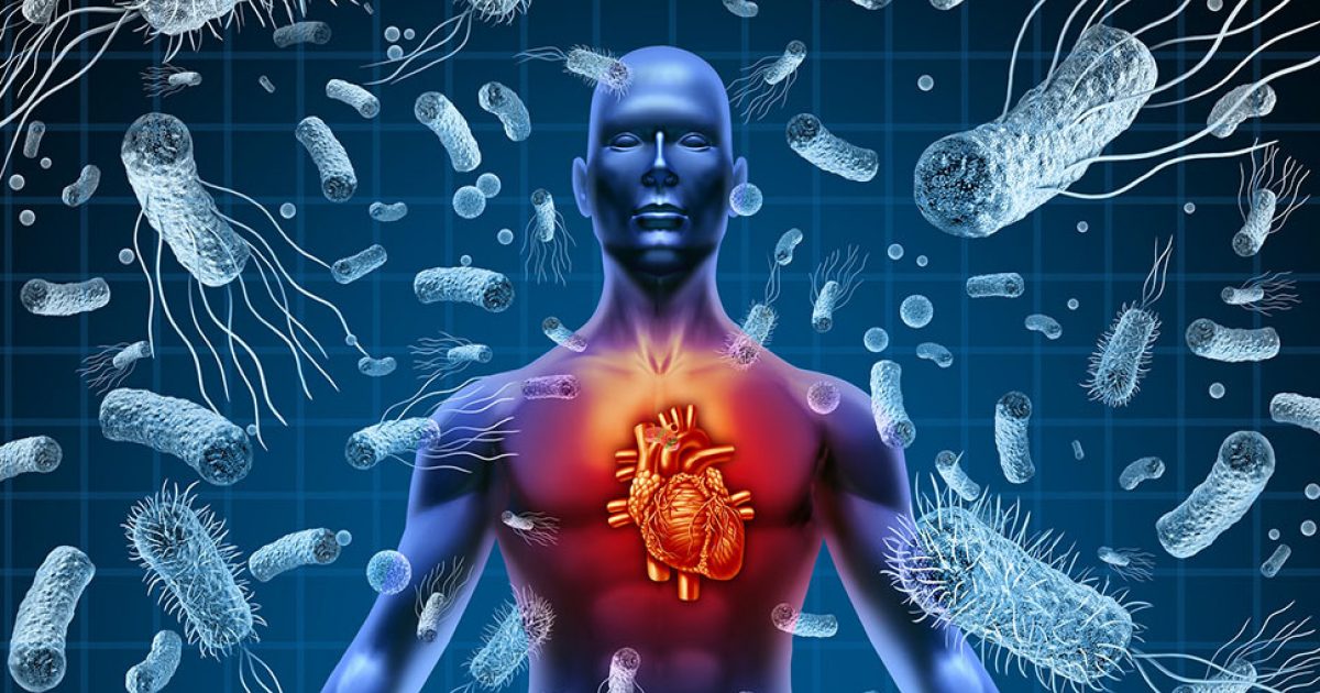 Staphylococcus aureus Endocarditis: A Selection of… | Clinician.com