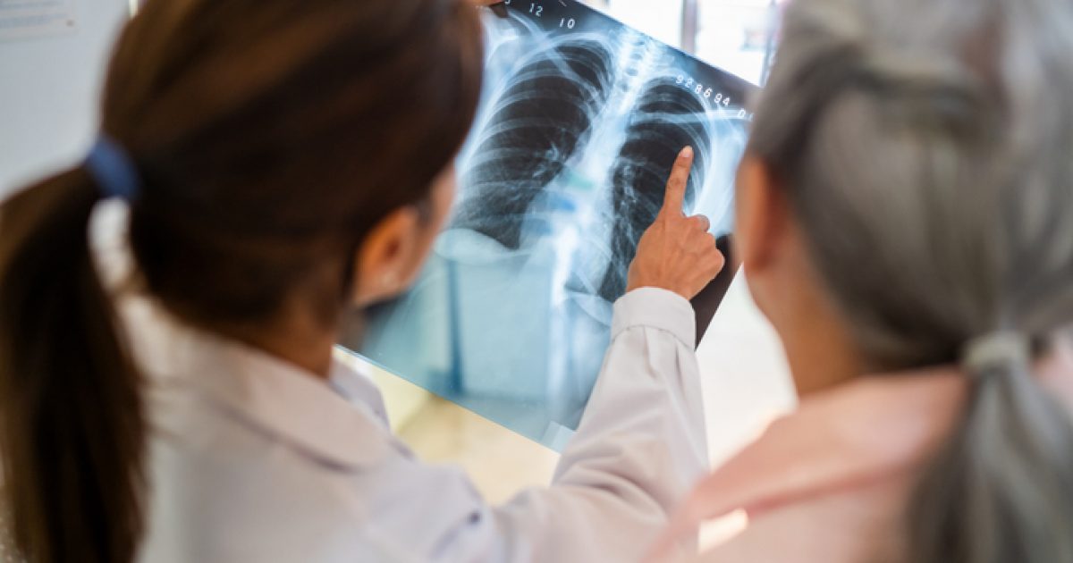 Telisotuzumab Vedotin-tlly (Emrelis) | Clinician.com