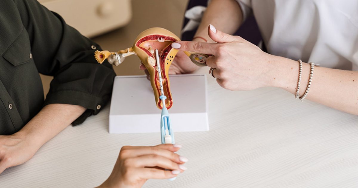 Malpositioned IUDs: How Easy Are They to Remove? | Clinician.com