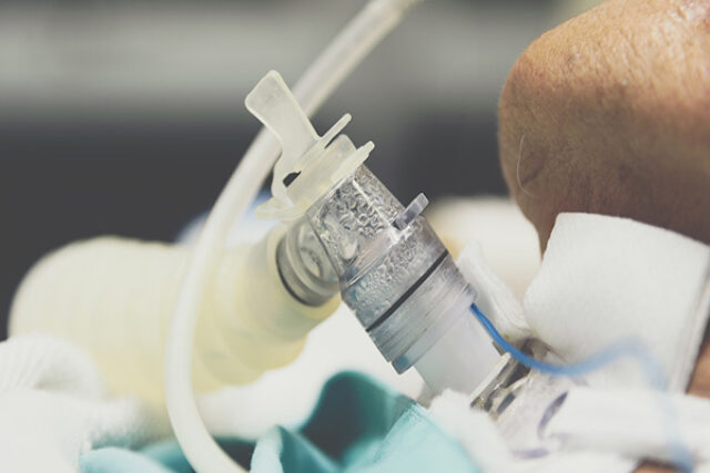 Novel Bedside Procedure Improves Tracheostomy Outcomes | Clinician.com